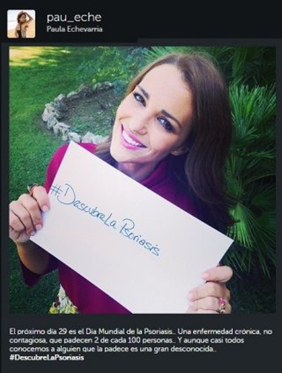 Campaña de sensibilización social #DescubreLaPsoriasis - Digitalist Hub